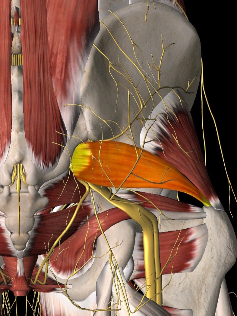 Piriformis Syndrome Specialist in Tampa, Florida — TampaPainMD